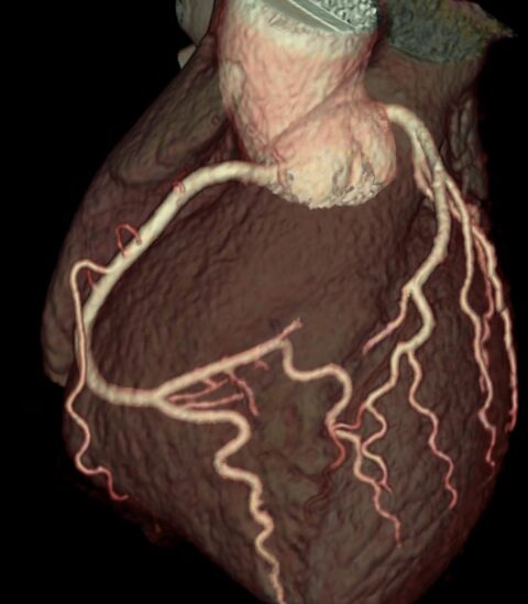 Christopher Kelly, MD, MS, FACC - Cardiologist in Raleigh and Cary, NC