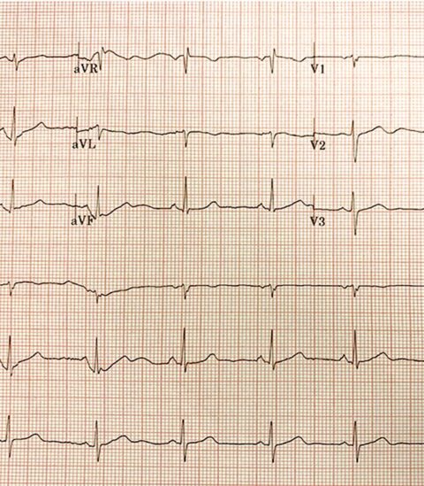 Christopher Kelly, MD, MS, FACC - Cardiologist in Raleigh and Cary, NC